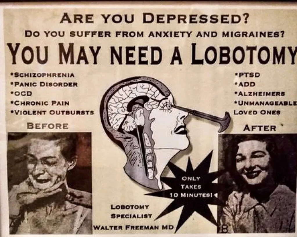 La troublante histoire de la lobotomie